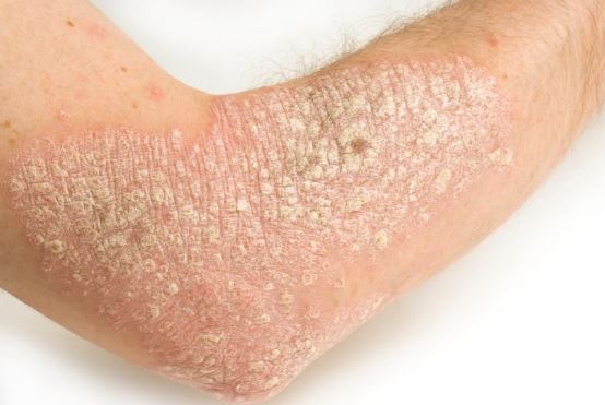 Rash On Arms And Legs Itchy Red Causes Small Bumps Pictures Not Itchy Skin Rash On Arms