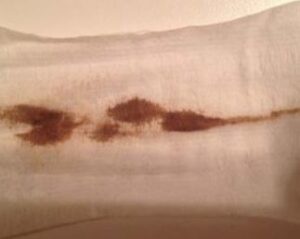 Brown Discharge during Ovulation, After, Before, Light, Pictures ...
