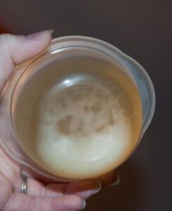 White Stuff in Urine - Causes, Meaning, Male, What To Do - Treat MD