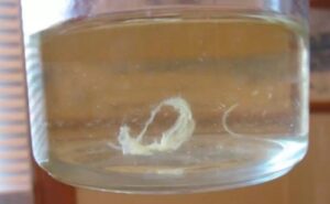 White Stuff in Urine - Causes, Meaning, Male, What To Do - Treat MD